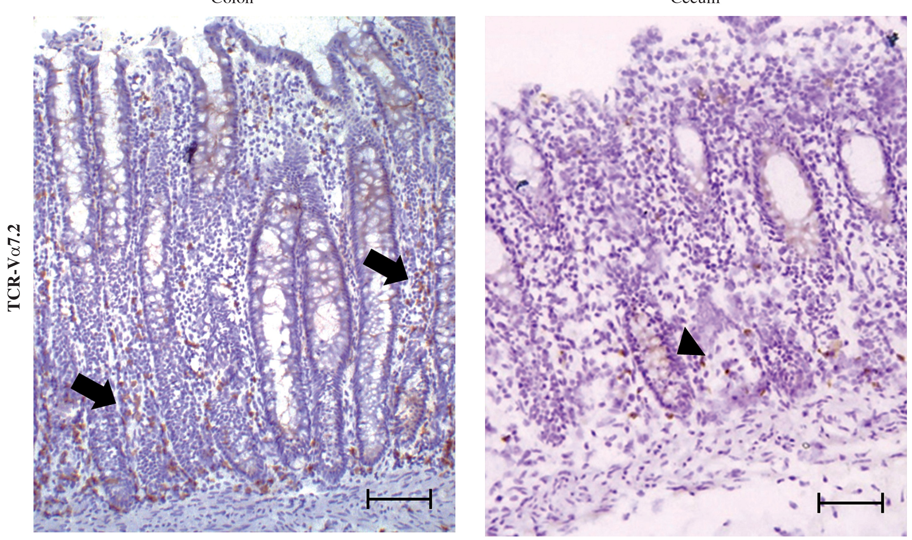 Different distribution of mucosal-associated invariant T cells within ...
