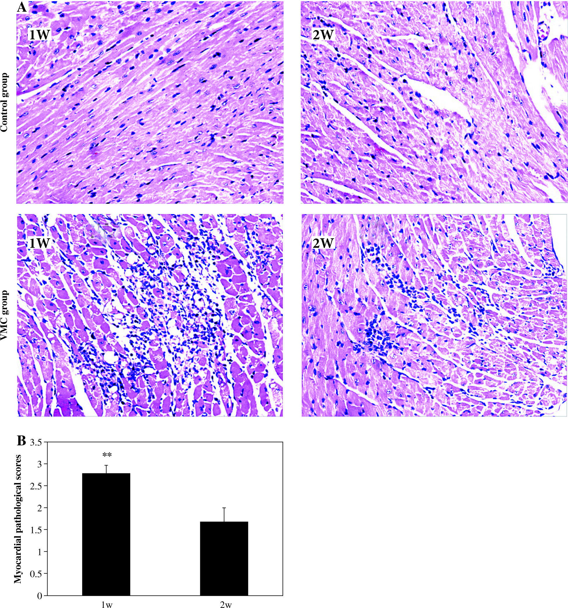 Expression of CD80 and CD86 on B cells during coxsackievirus B3-induced ...
