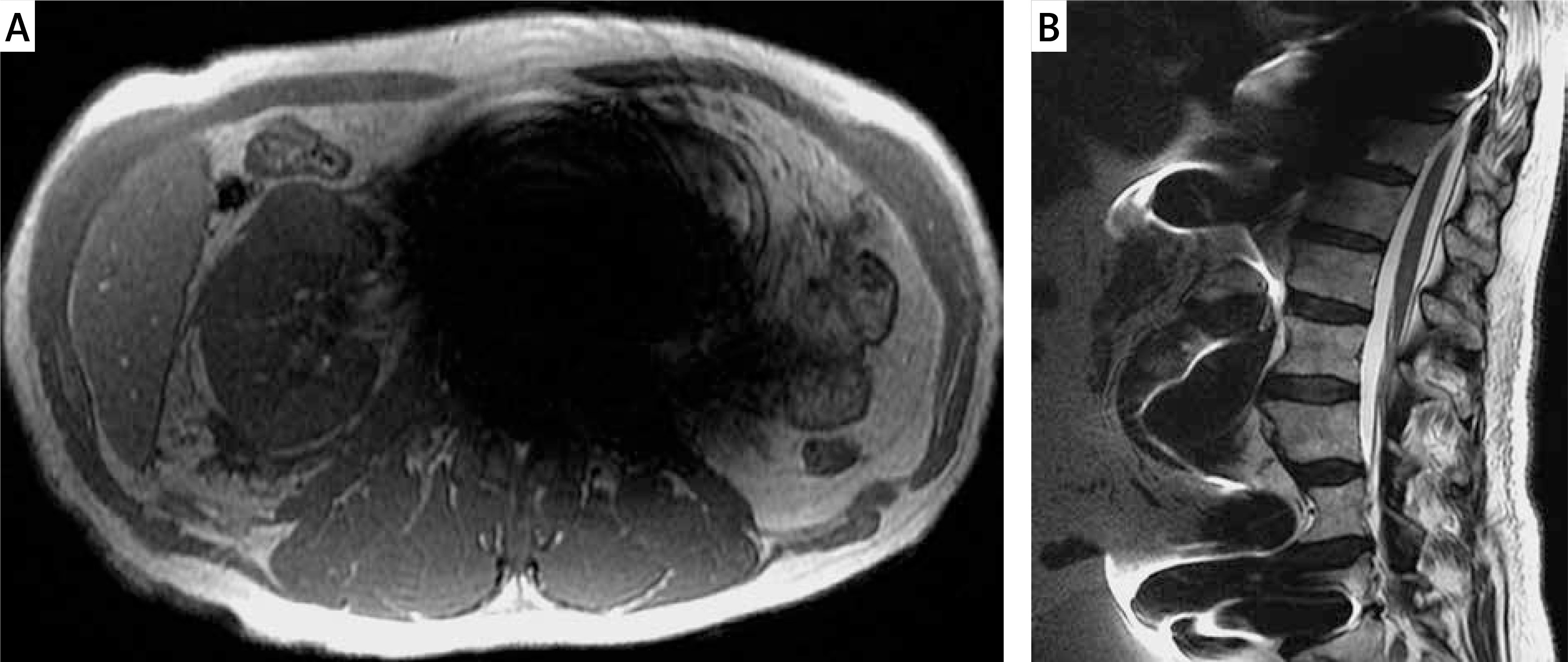 Contemporary imaging methods for the follow-up after endovascular ...
