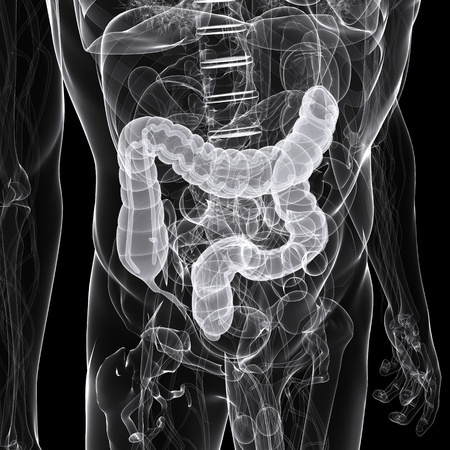 Jak oczyścić jelito grube po uprzednim niewłaściwym przygotowaniu do ...