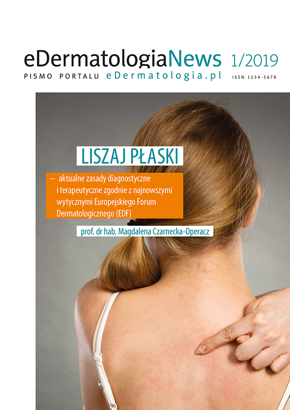 Liszaj płaski – aktualne zasady diagnostyki i terapii, zgodne z ...