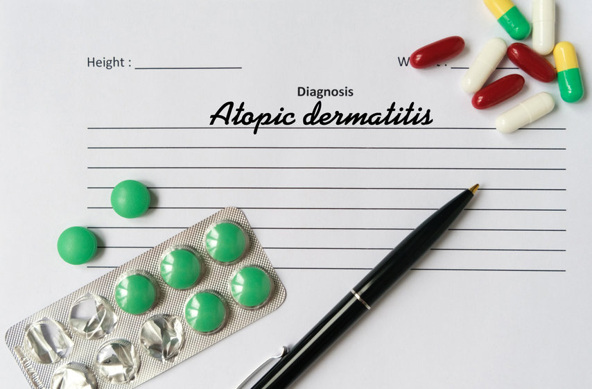 Skuteczne leczenie AZS staje się rzeczywistością - Dermatologia – Termedia